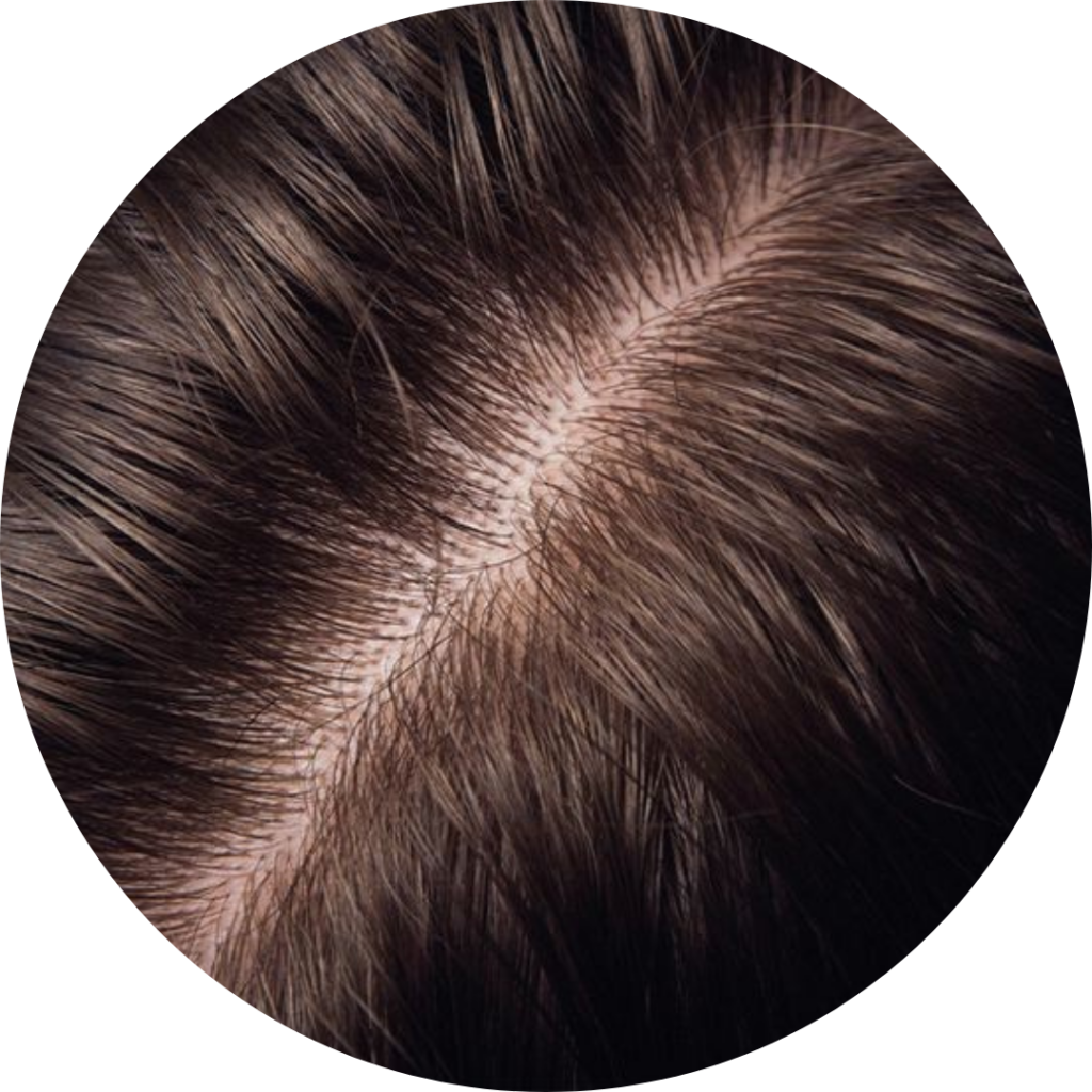 Antidandruff Product Range - Auraceutics Aesthetic Healthcare